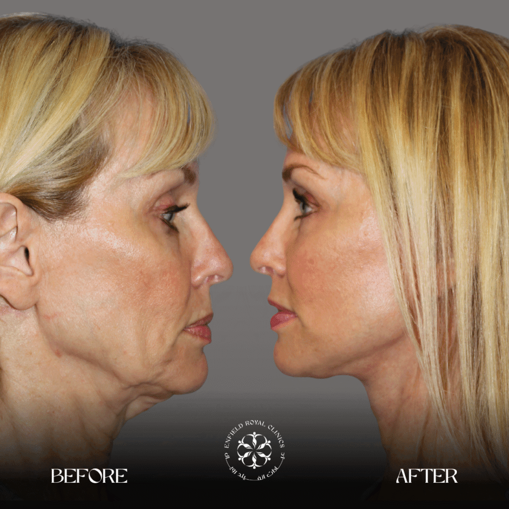 Cosmetic Surgery in Riyadh from 15000 SAR | Saudi Offers